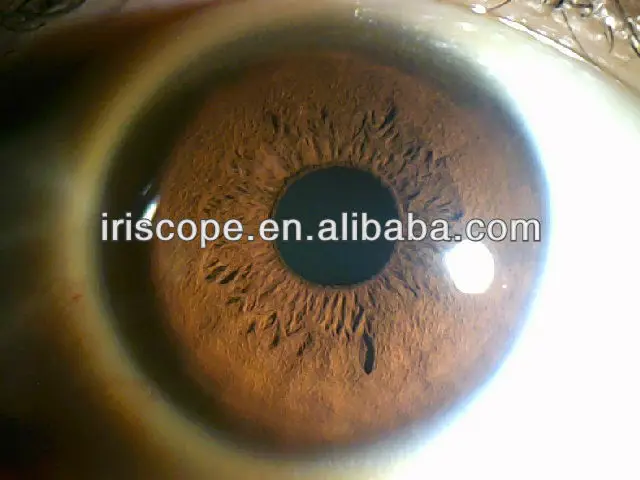 2018 Iris Test Instrument Iris Analyzer / Computer Iris Instrument ...