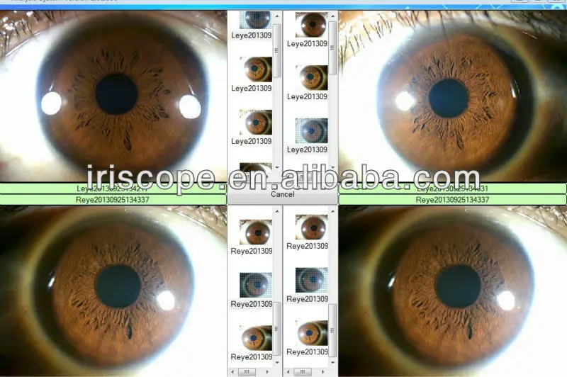 2018 Iris Test Instrument Iris Analyzer / Computer Iris Instrument ...