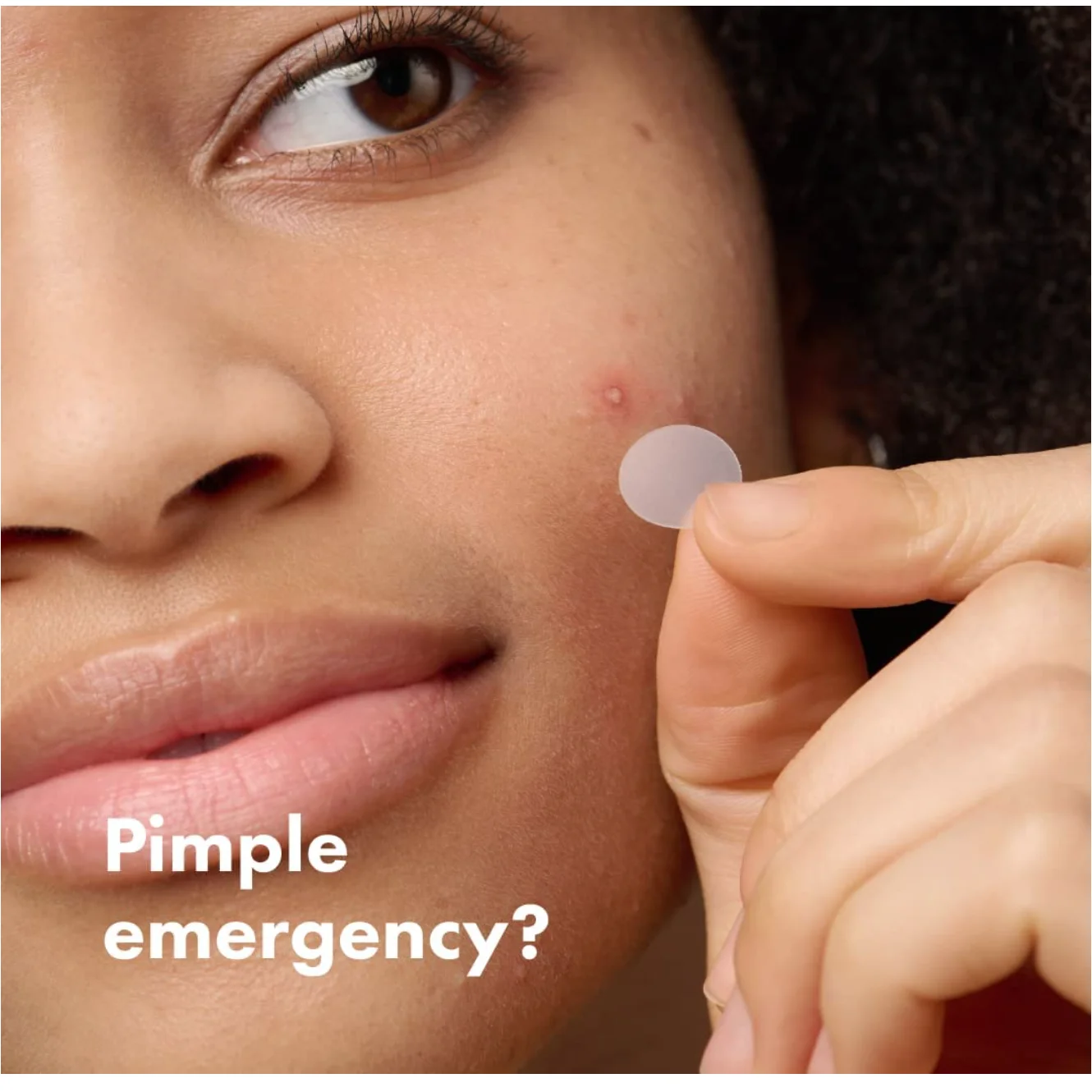 Pimples Patch Hydrocolloid Acne Pimple Patch To Cover Zits & Blemishes ...
