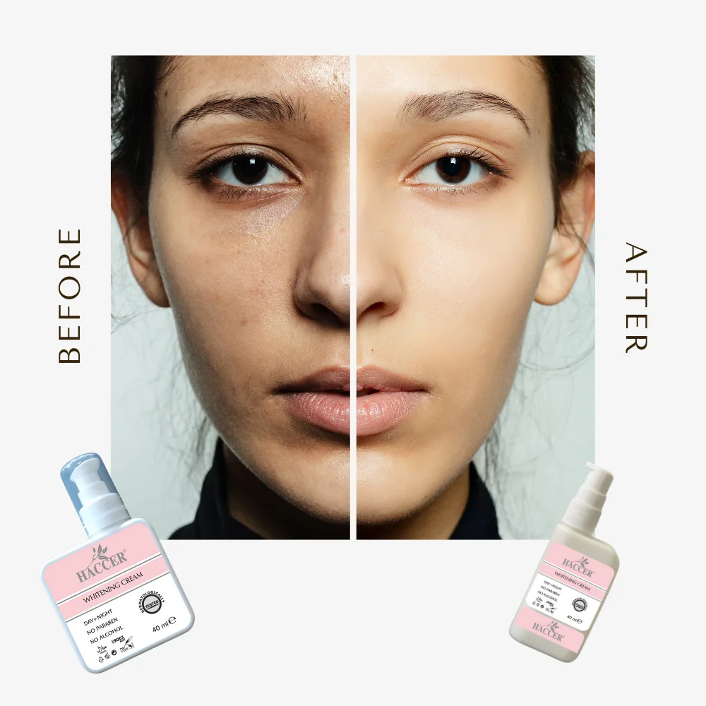 Haccer Whitening Cream Lotion Face Body Dark Skin Brightening Cream ...