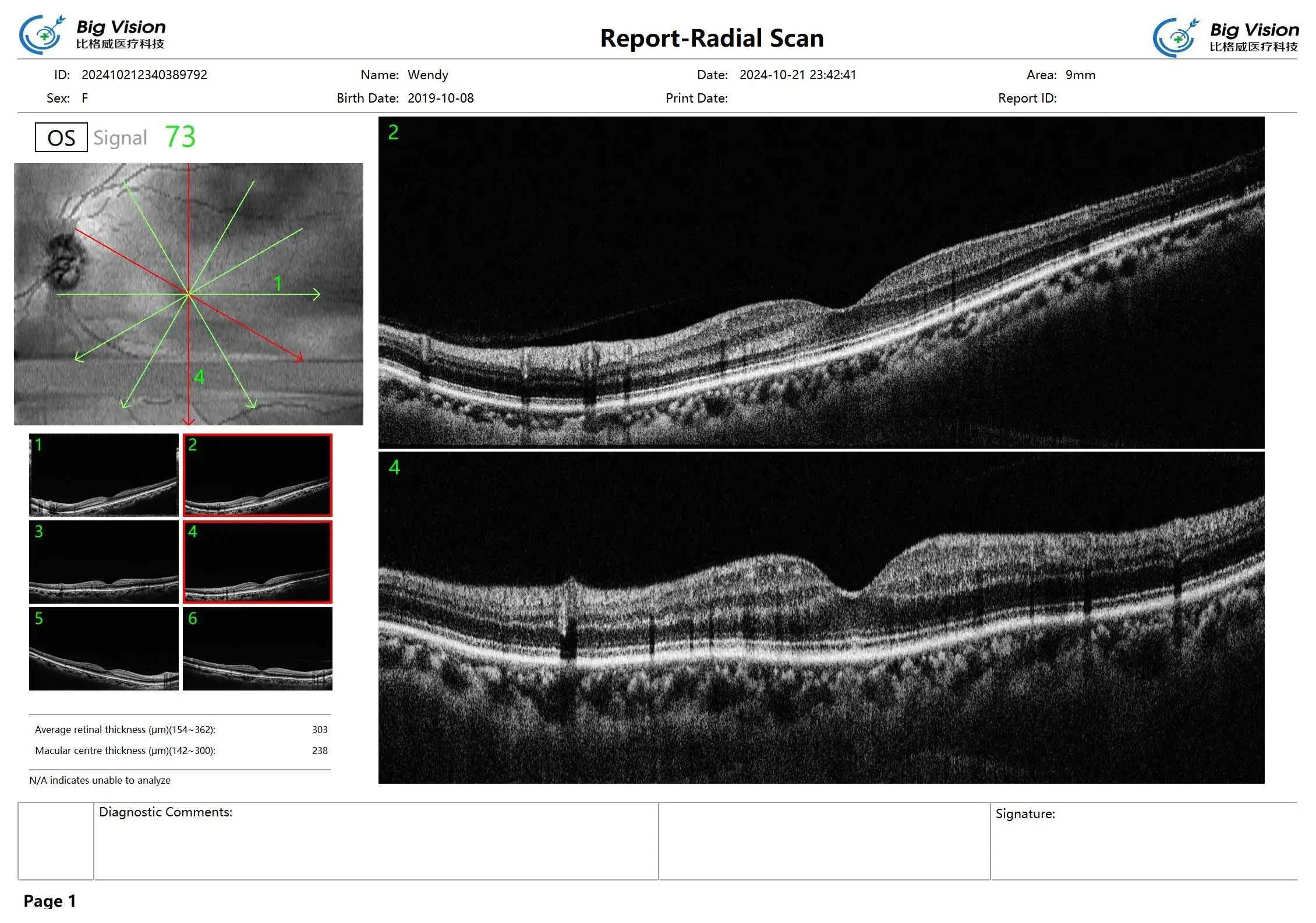 Optical Coherence Tomography (OCT) Machine by GOGO VISION