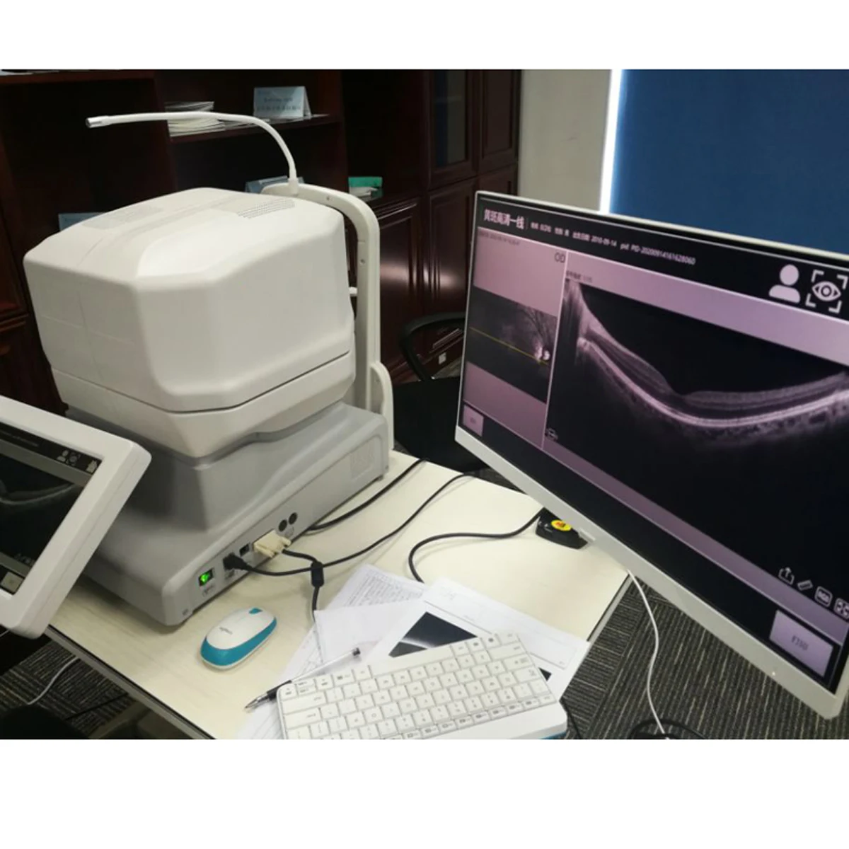 MSL Optical Coherence Tomography - High Quality OCT Scanner