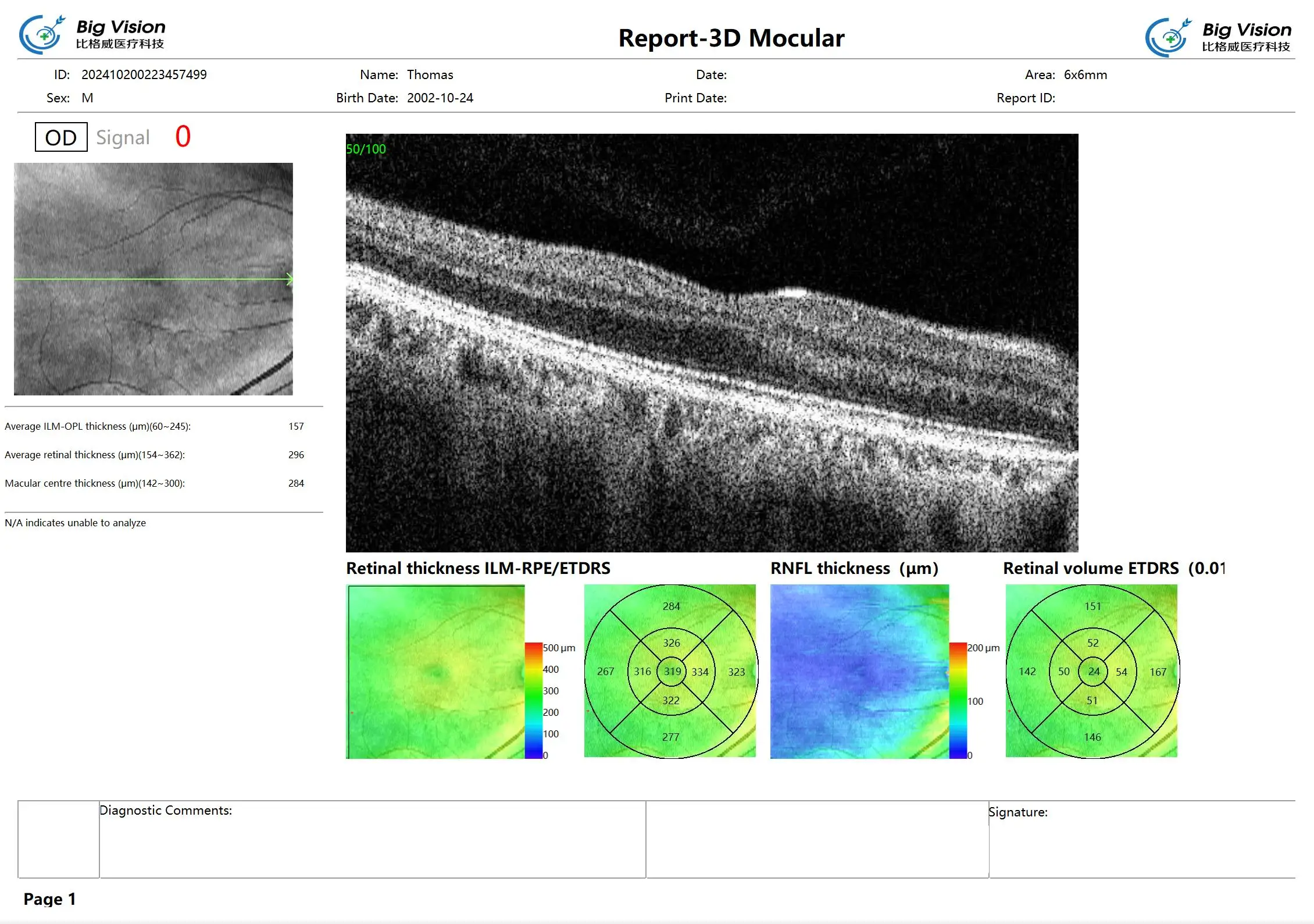 Optical Coherence Tomography (OCT) Machine by GOGO VISION