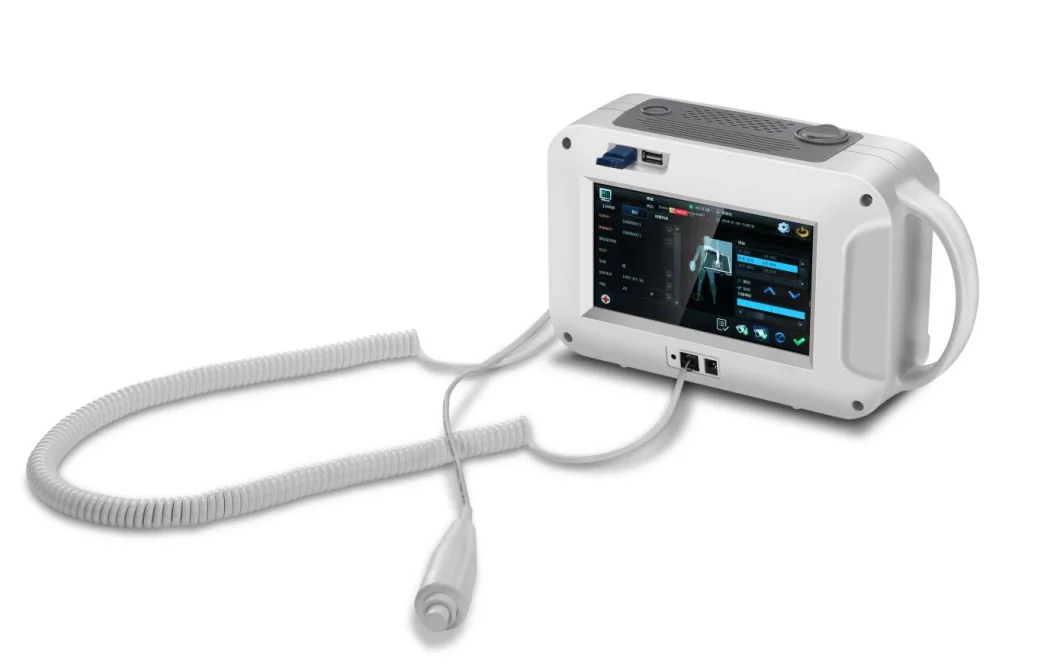 Portable Handheld X Ray Machine - Reliable Medical Radiography