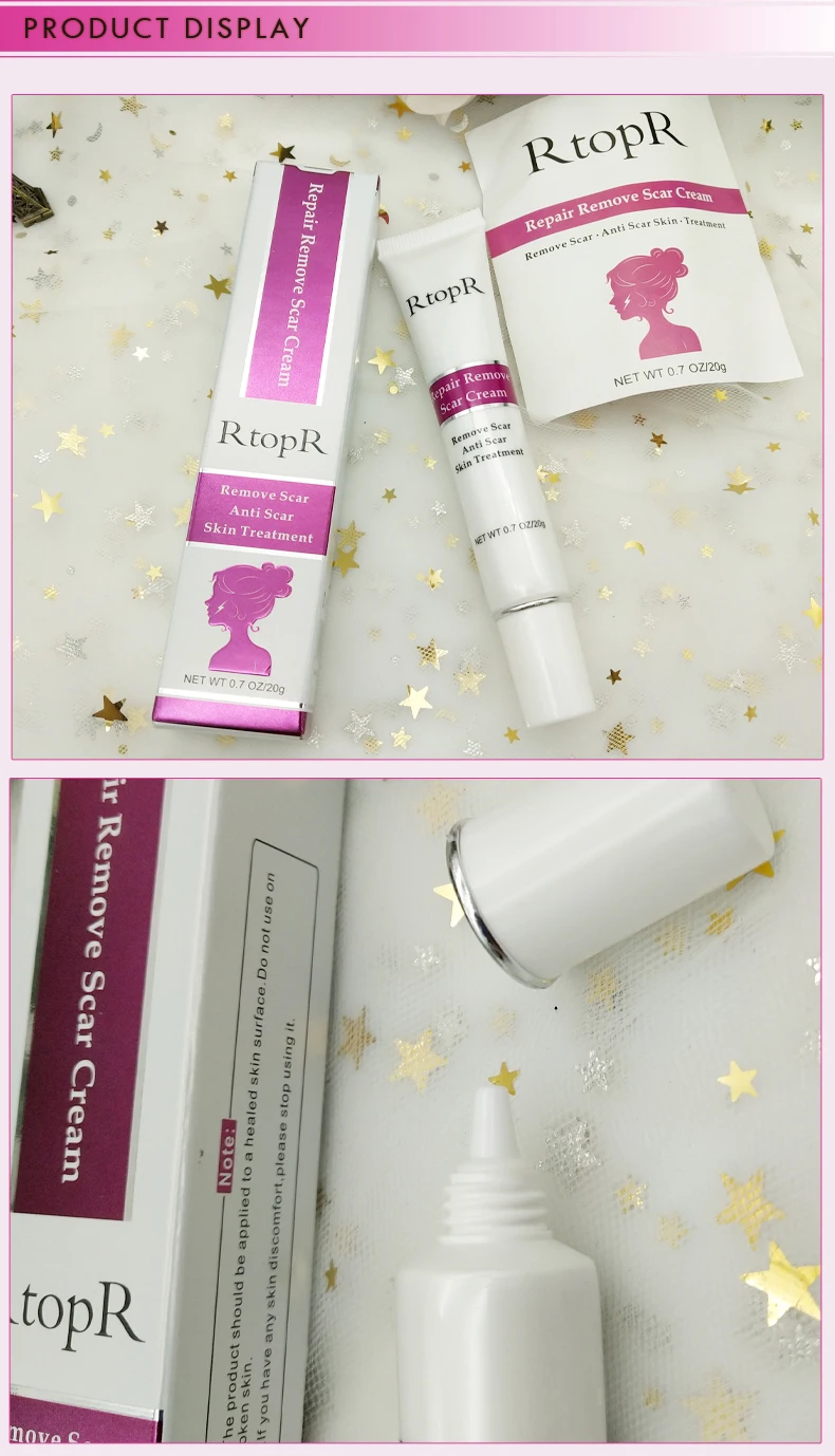 Rtopr Brand Remove Scar Anti Scar Skin Treatment Repair Remove Scar ...