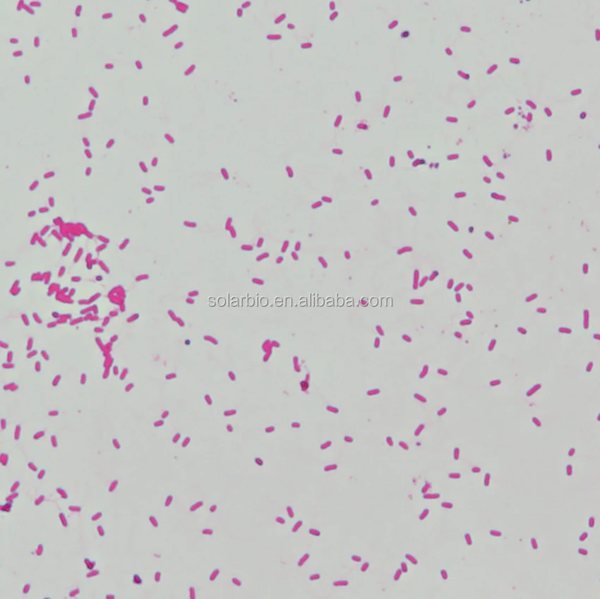 Solarbio Flagella Stain Kit - High Quality Carbol Fuchsin