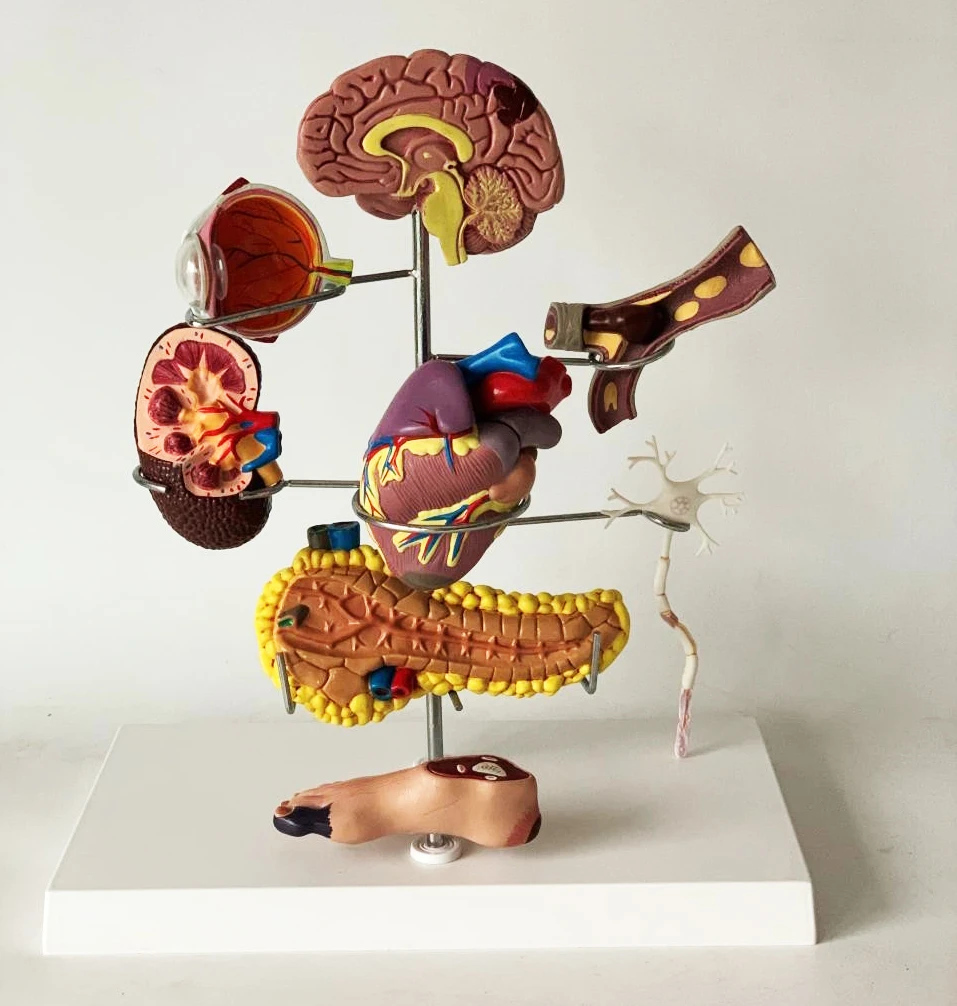 Gelsonlab Medical School Bilological Model Diabetes Model - Buy ...