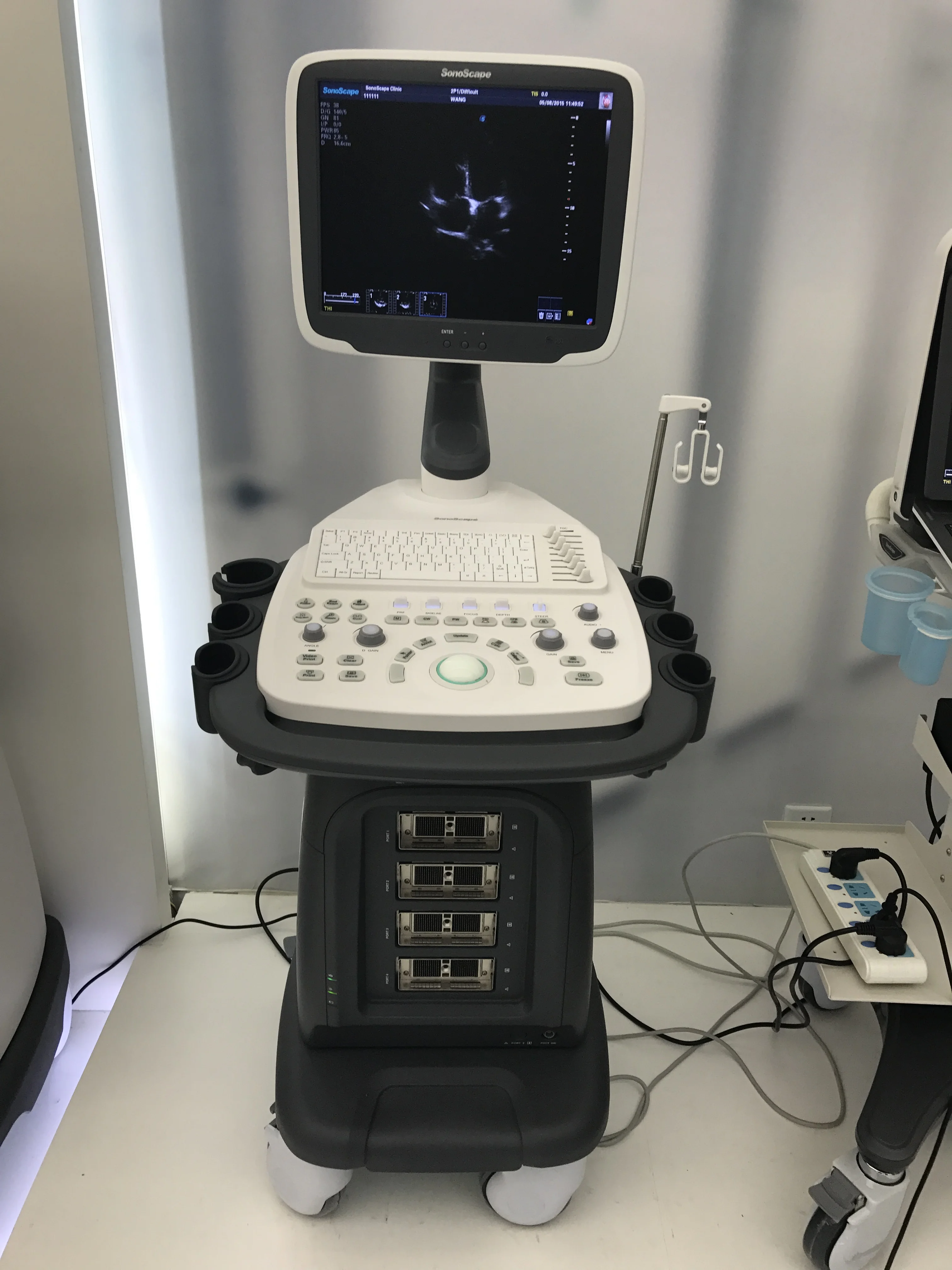 4D Sonoscape S12 Ultrasound Portable Color Doppler System