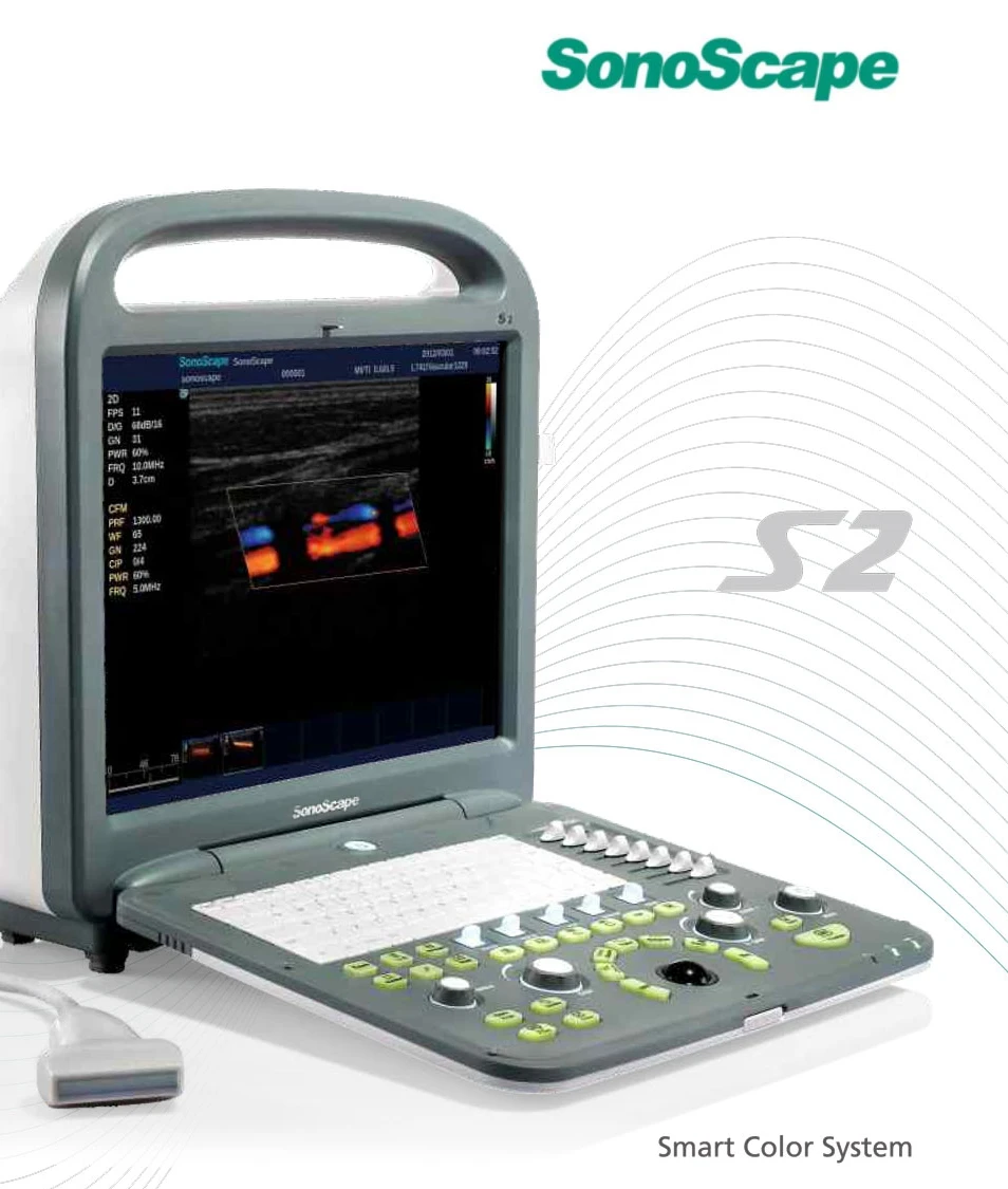 Sonoscape S2 Color Doppler Ultrasound Scanner For Muscle-skeletal ...