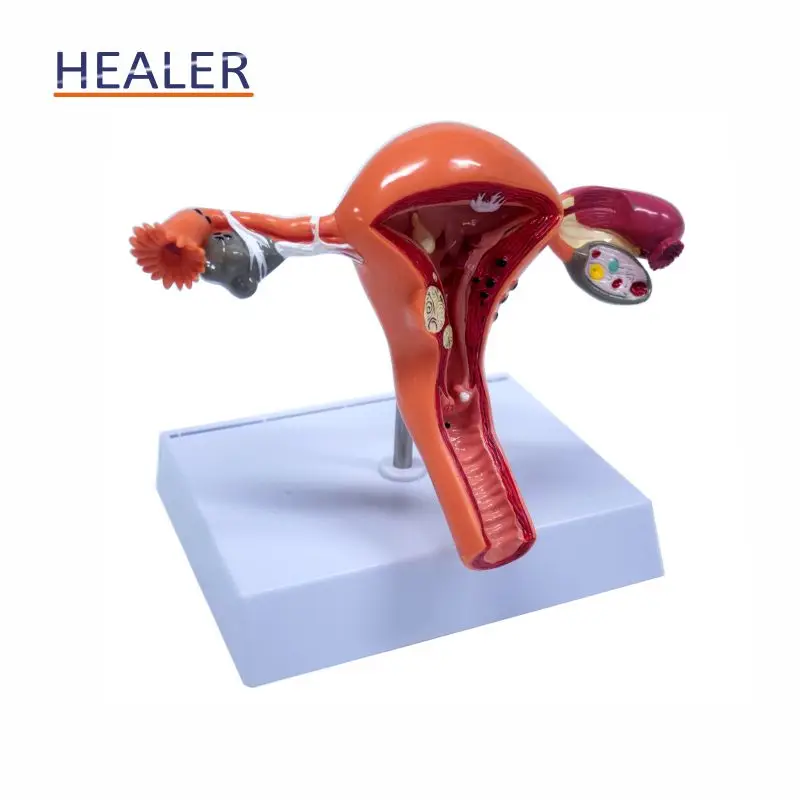 Anatomic Model Of Female Reproductive Organ Uterus Vagina,Female Womb ...
