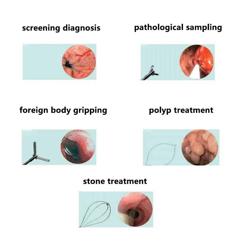 Medical Laparoscopy Tower Laparoscopic Instrument Laparoscopet Surgery ...