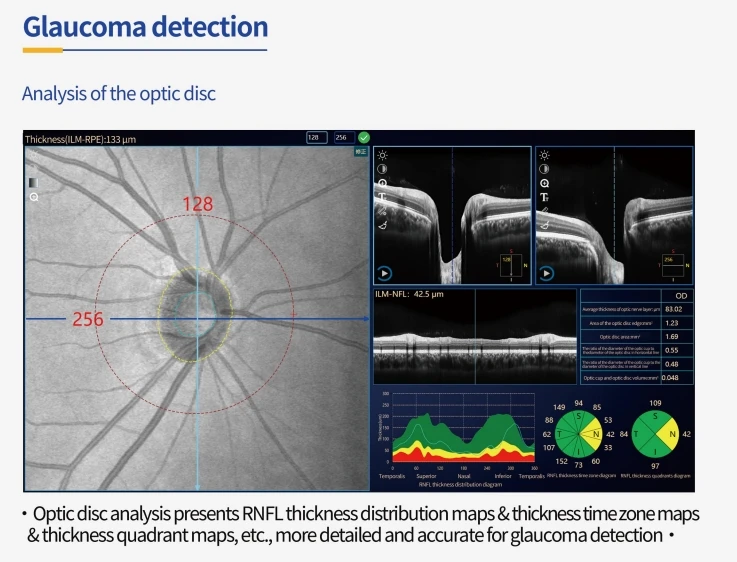 Optical Coherence Tomography Velite C808B - Intelligent Ophthalmology ...