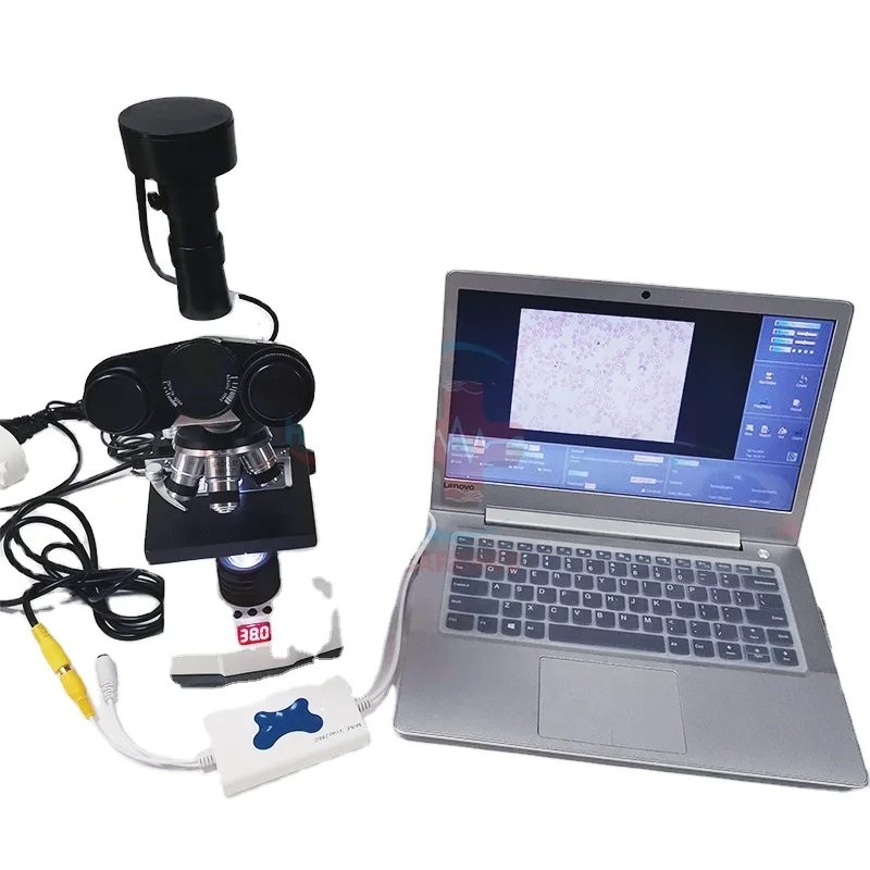 Hc-B028V Upgraded Human Sperm Analyzer Machine Canine Semen Analyzer Price| Alibaba.com