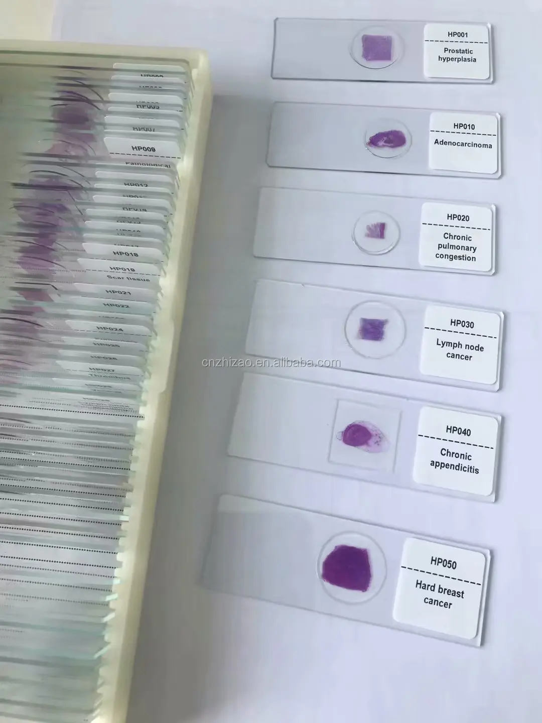 Fixed Set 50 Kinds Human Pathology Microscope Prepared Slides For ...