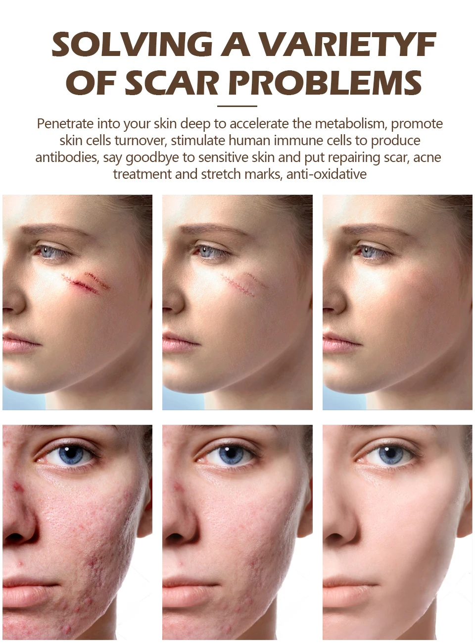 Vibrant Glamour Crocodile Repair Scars Cream Face Acne Spots Lighten ...