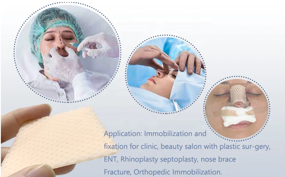 Thermoplastic Nasal Splint for Rhinoplasty & Rehabilitation