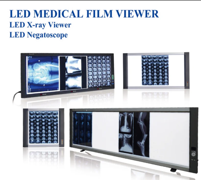 MSL X-Ray Film Viewer - Bright, Reliable LED Illumination