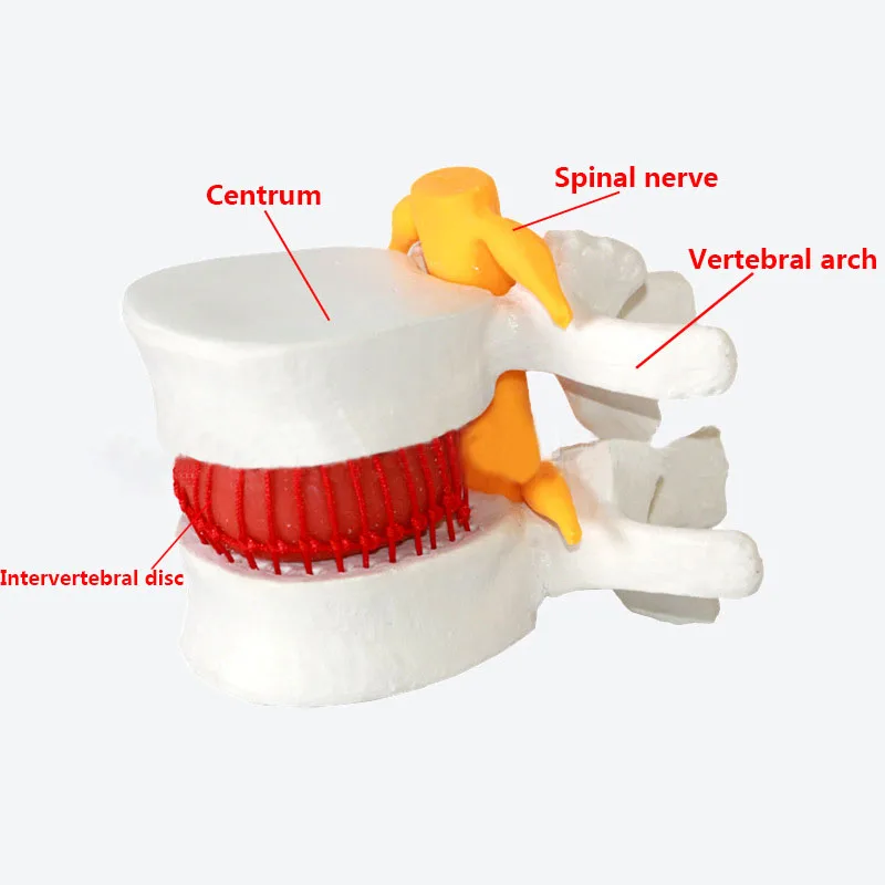 Lumbar Disc Herniation Demonstration Model for Medical Science