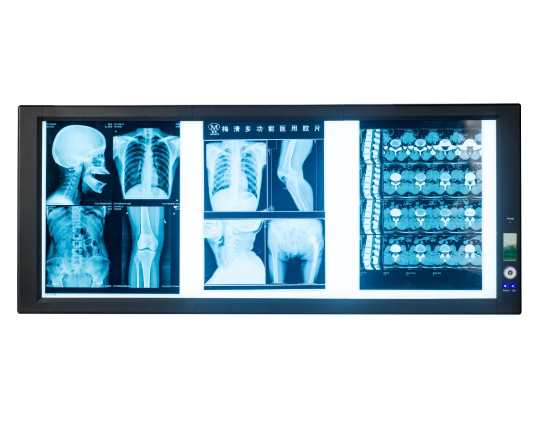 MSL X-Ray Film Viewer - Bright, Reliable LED Illumination