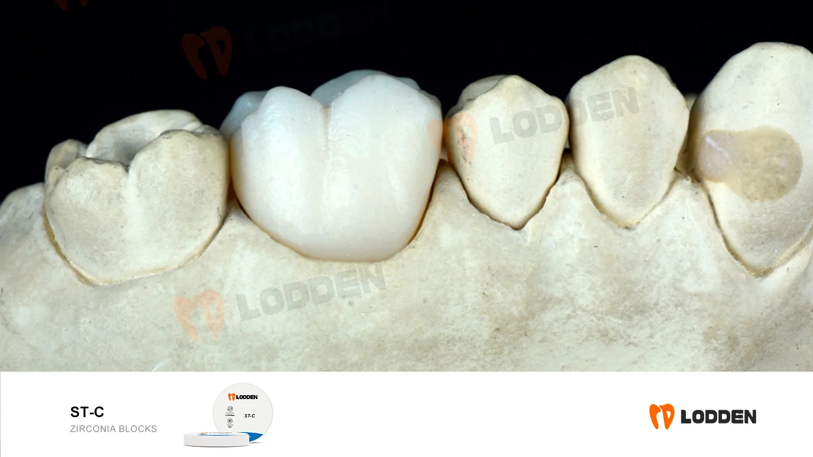 Lodden Zirconia Blocks - Premium Dental Ceramic Solutions
