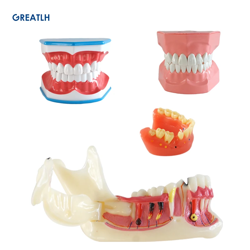 Dental Porcelain Oral Dental Porcelain Typodont Teeth Model Dental ...