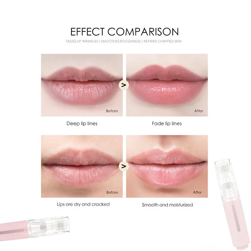 Vegan Lip Plumper - Enhance Your Lips with Beauty Rollers