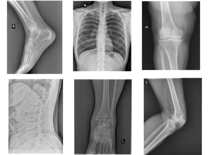 20kw, 32kw, 50kw High Frequency Digital Mobile Ray Machines