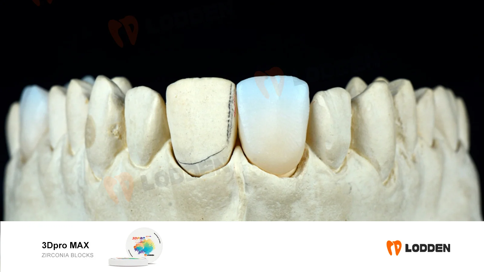 Lodden Zirconia Blocks - Premium Dental Ceramic Solutions
