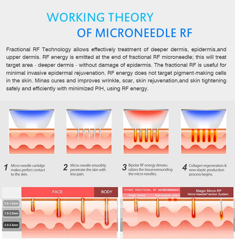 Beauty Products for Women Microneedling Radiofrequenz Professional ...