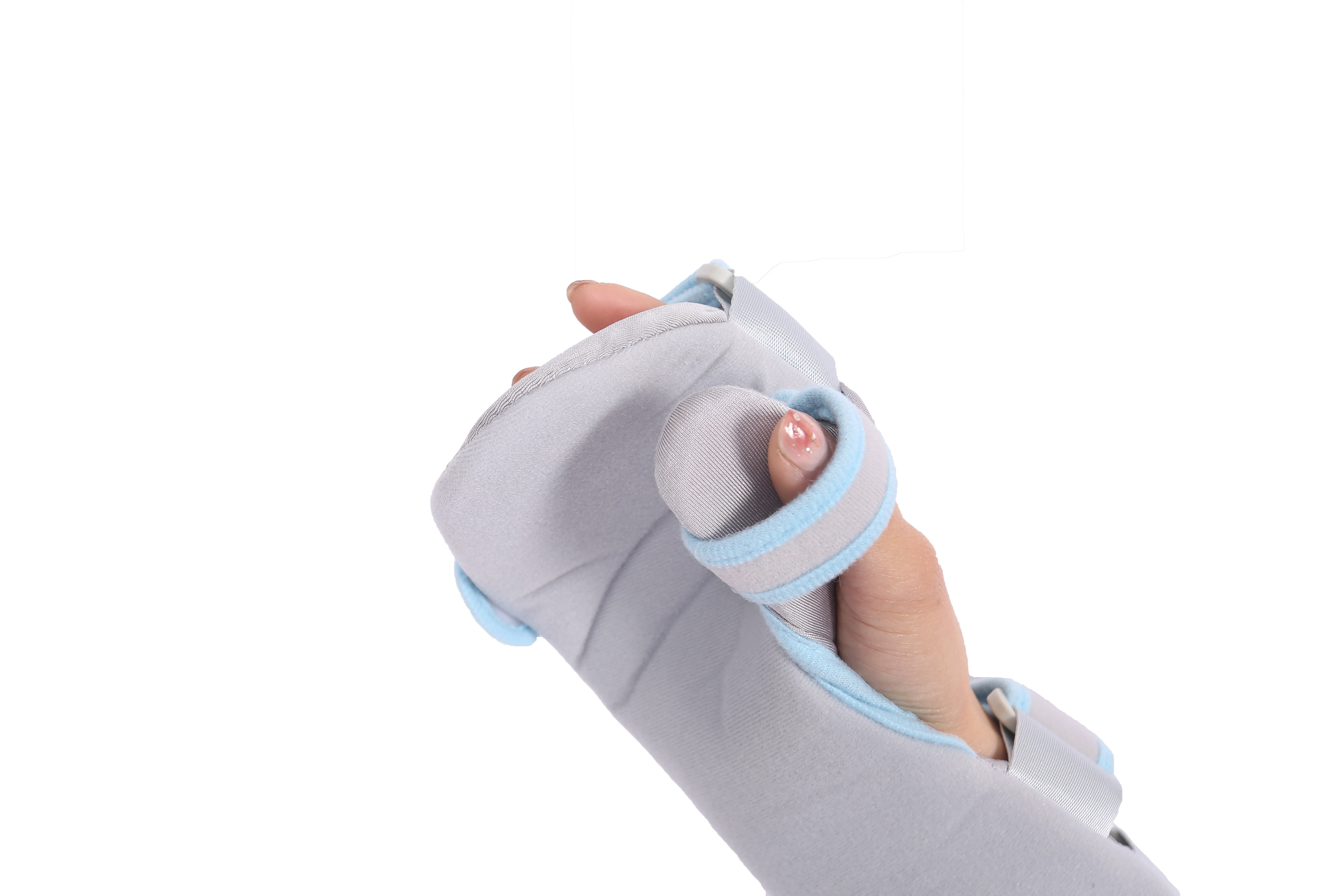 Orthopedic Hand Immobilization Fracture Arthritis Dislocation Forearm ...