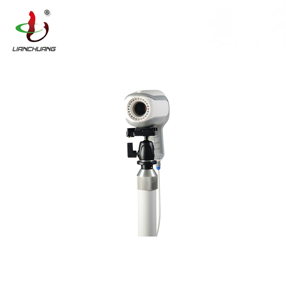 Digital Camera Colposcope Machine/electronic Colposcopy Instrument For ...