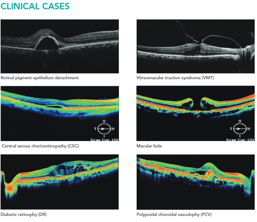 SJ Optics Oct Ophthalmological Ose 2800 Anterior and Posterior Segment ...