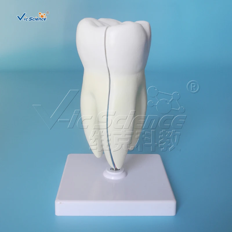 Human Teeth Anatomical Model Molar Tooth Attach With Caries Maxillary ...