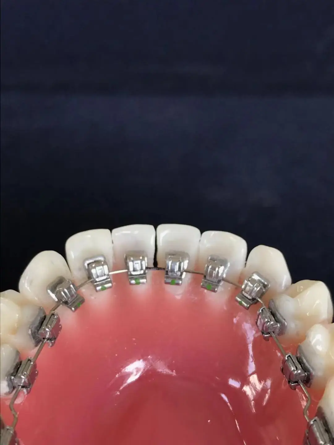 Damon Q Passive Self-ligating Brackets With Stable And Smooth Cap - Buy ...