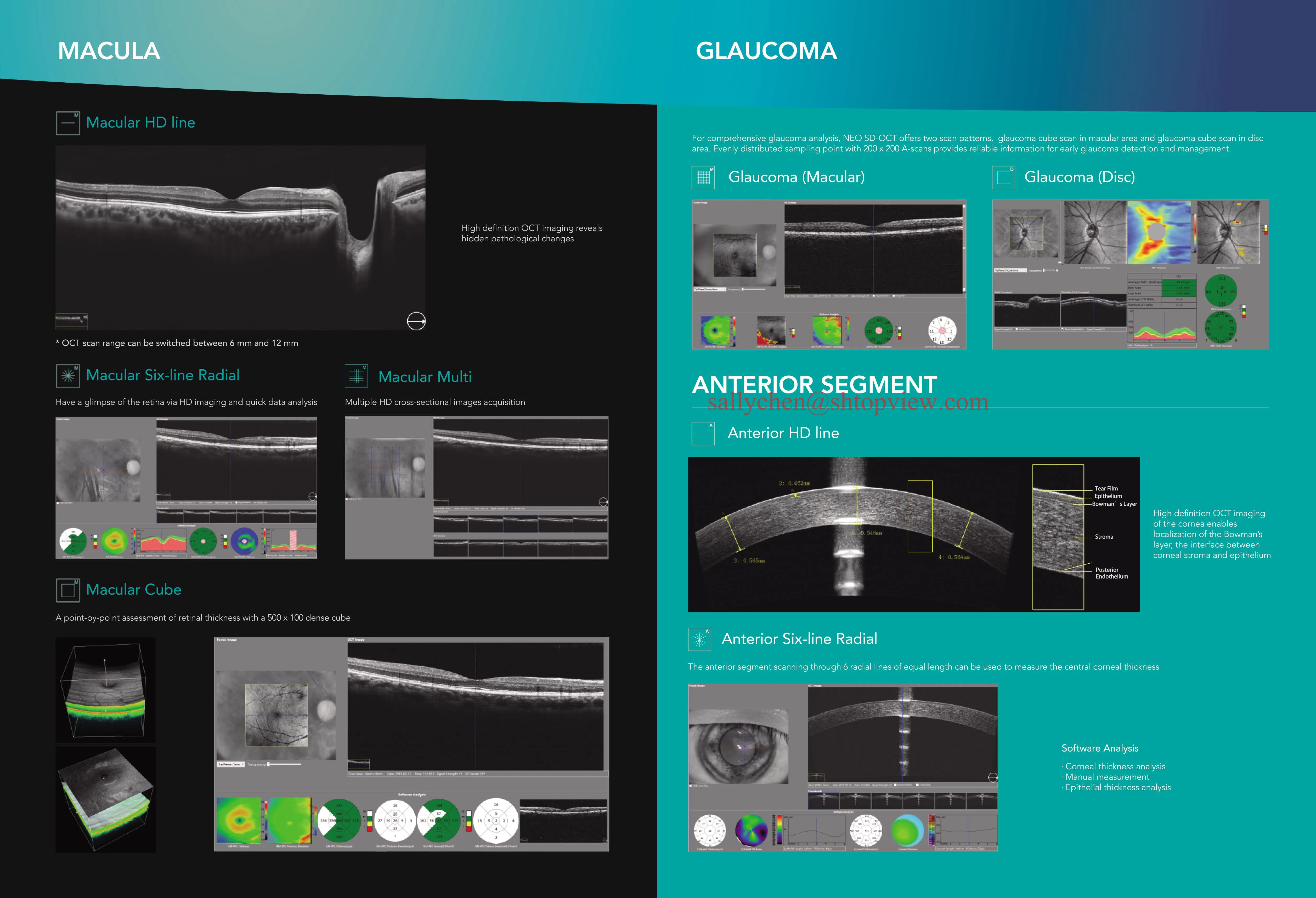 OSE-2800AS Ophthalmic OCT Machine for Anterior & Posterior Segment Imaging