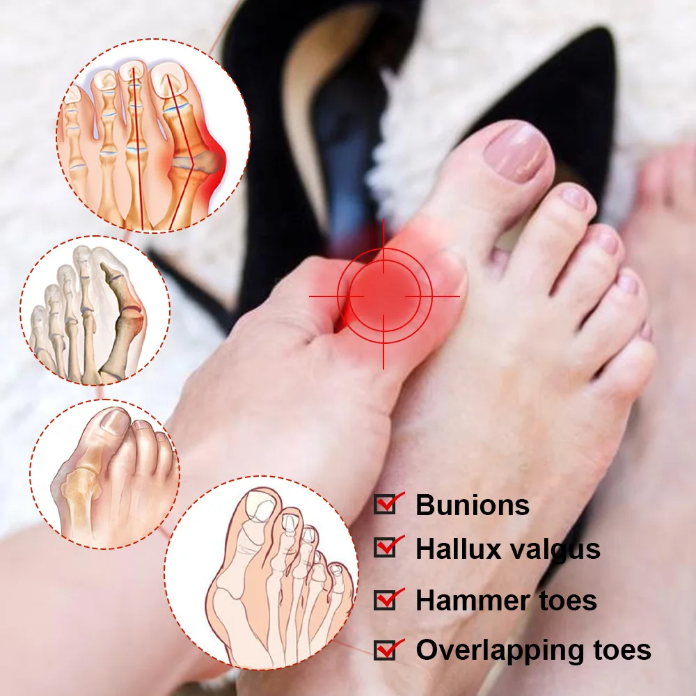 Bunion Arthritis Pain Stiffness Relief Spray Wrist Elbow Knee Pain ...
