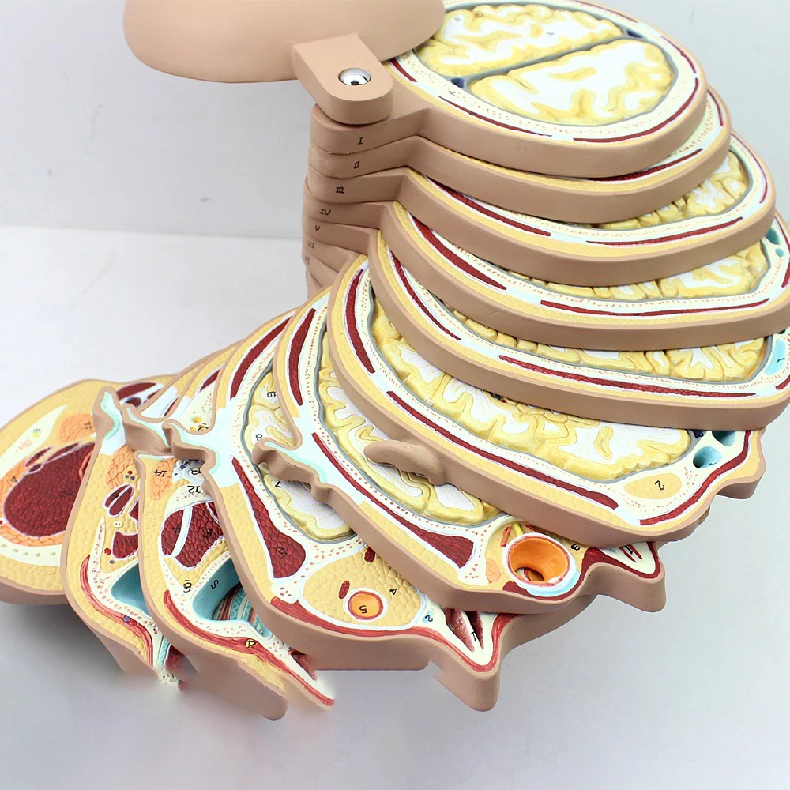 Cross-sectional Brain Anatomy Model for Medical Teaching
