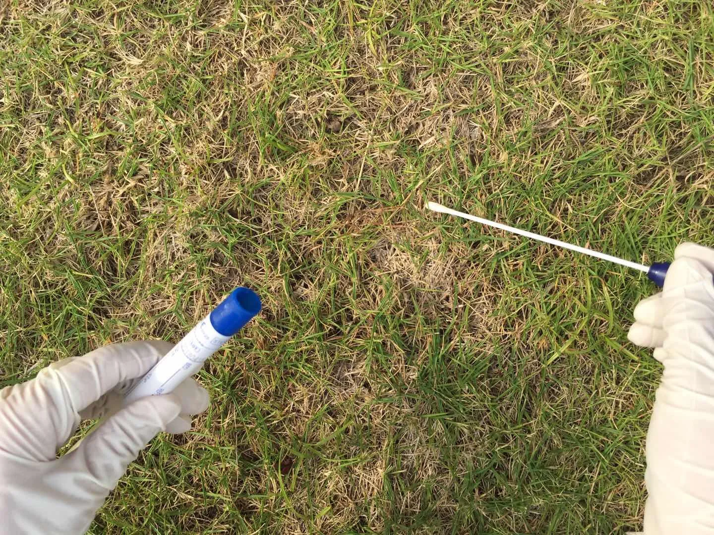 Disposable Sterile Microbiology Test Oral Throat Specimen Collection ...