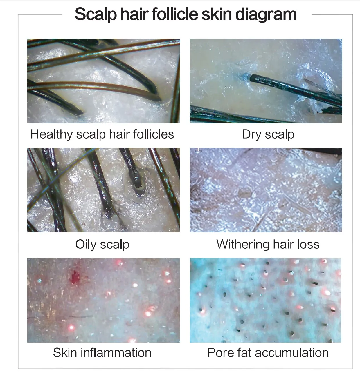 Multi-function Hair Analyser Four-spectrum Hair Follicle Detector Scalp ...