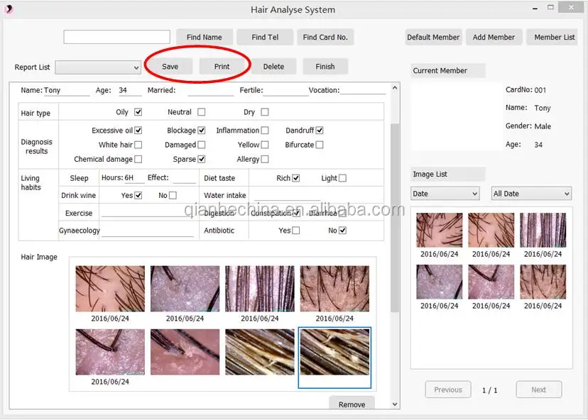 Intelligent Hair Analyzer - Scalp Scope Microscope Analysis