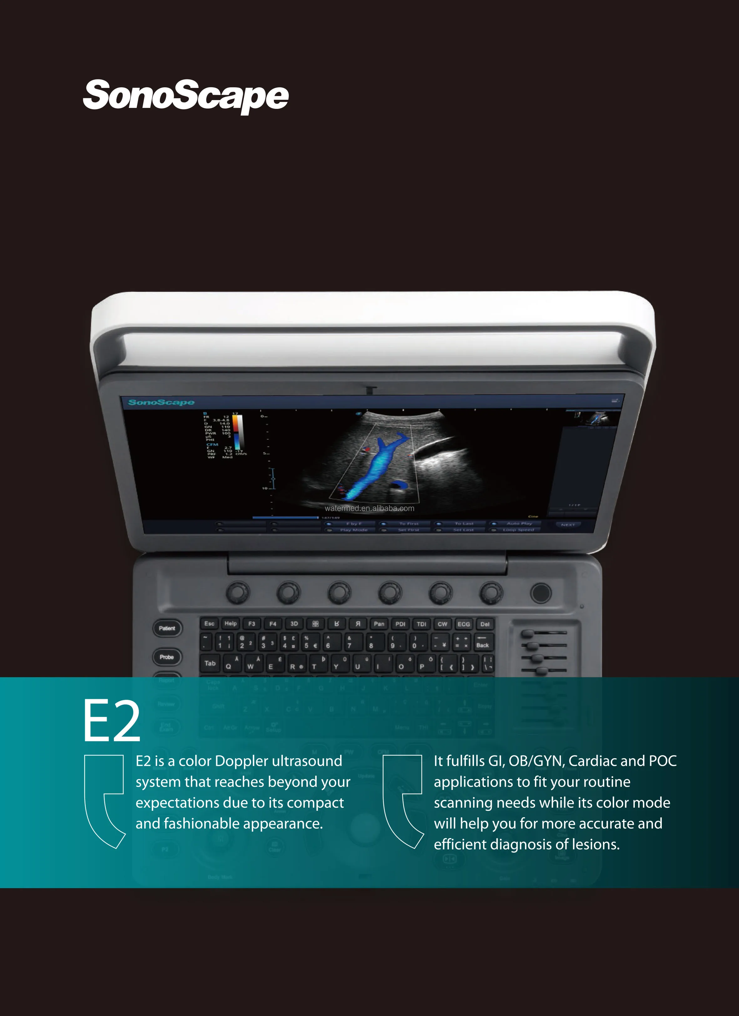 MSK Ultrasound TDI CW Color Sonoscape E2 E3 & Sonoscape E1 Usg
