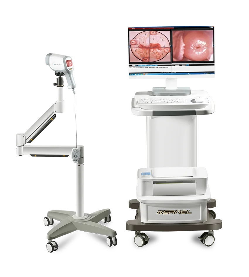 Kernel Colposcopy Examination Surgical Instruments Full Hd Camera ...