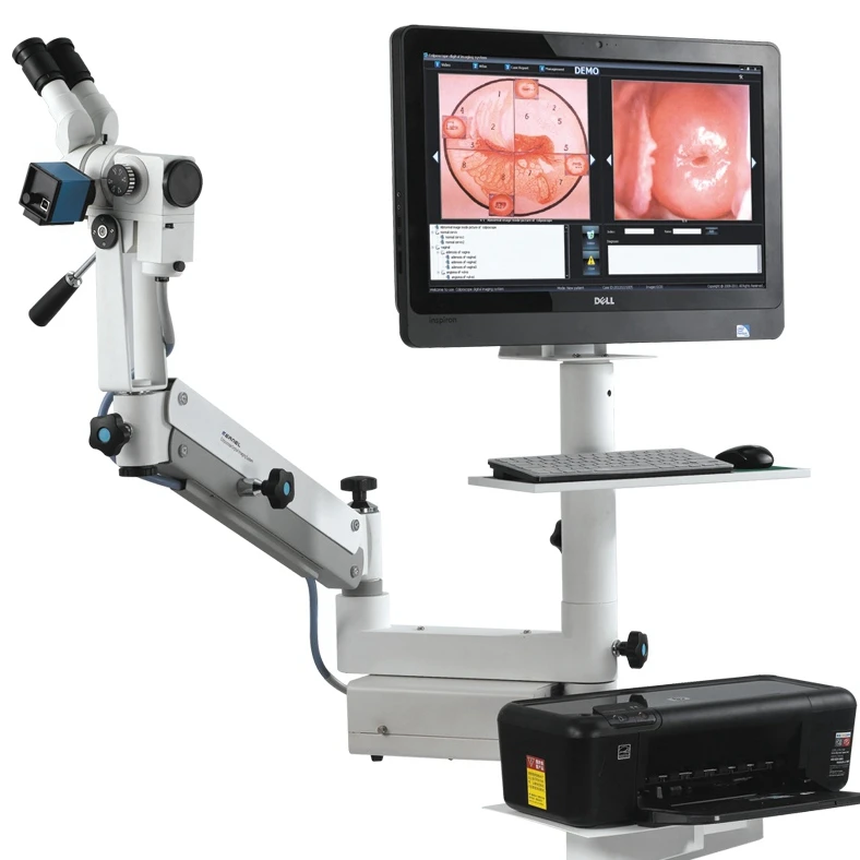 Kernel Kn--2200bii Optical Colposcope For Gynecology Vaginal Cervix ...