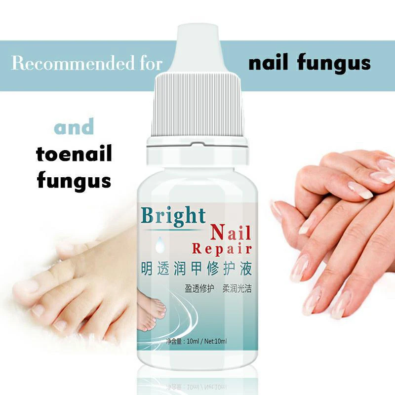 10ml Fungal Nail Treatment Essence Nail Foot Whitening Toe Fungus ...