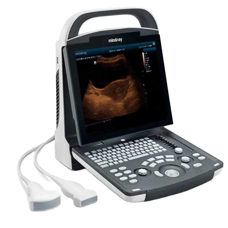 Mindray DP-10 Ultrasound - Portable and Versatile Machine