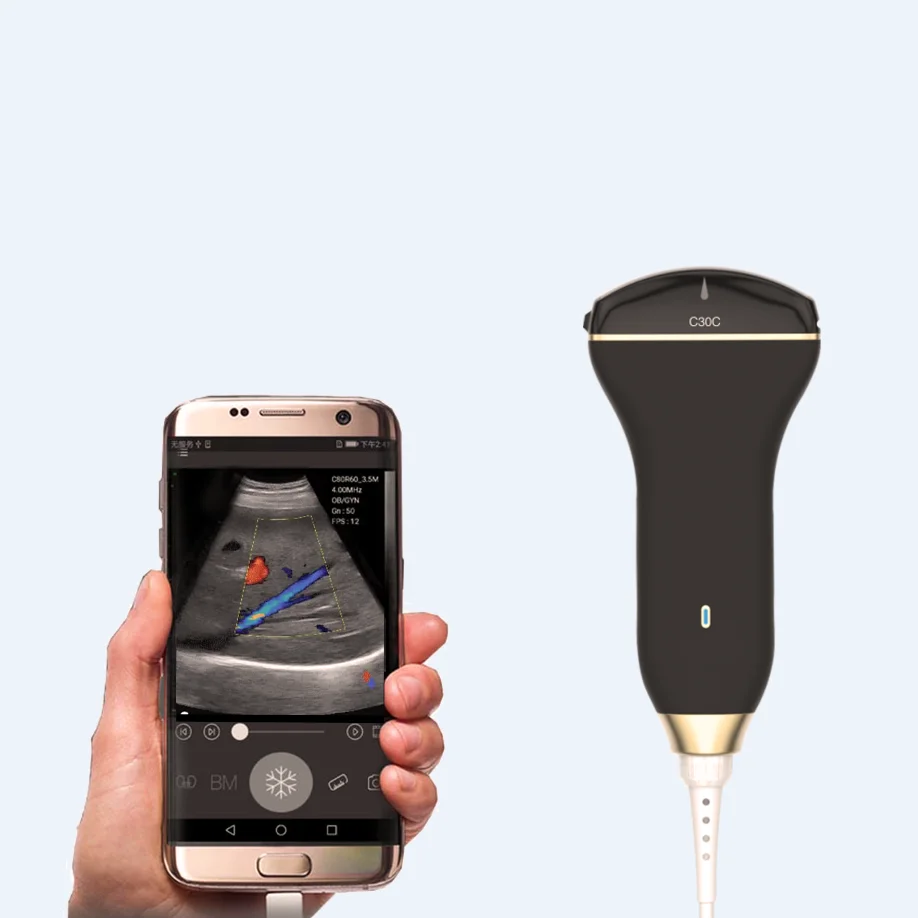 Portable Wireless Ultrasound Handheld Wireless Ultrasound Wireless ...