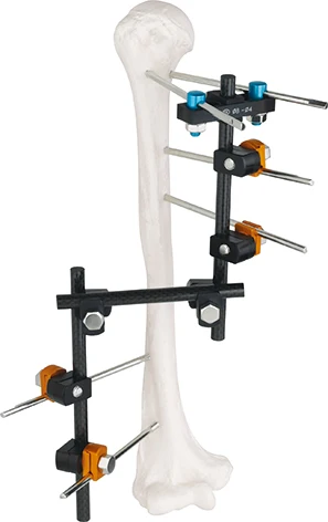 External Fixator For Z Frame (t Type) - Buy External Fixator,Fixator ...