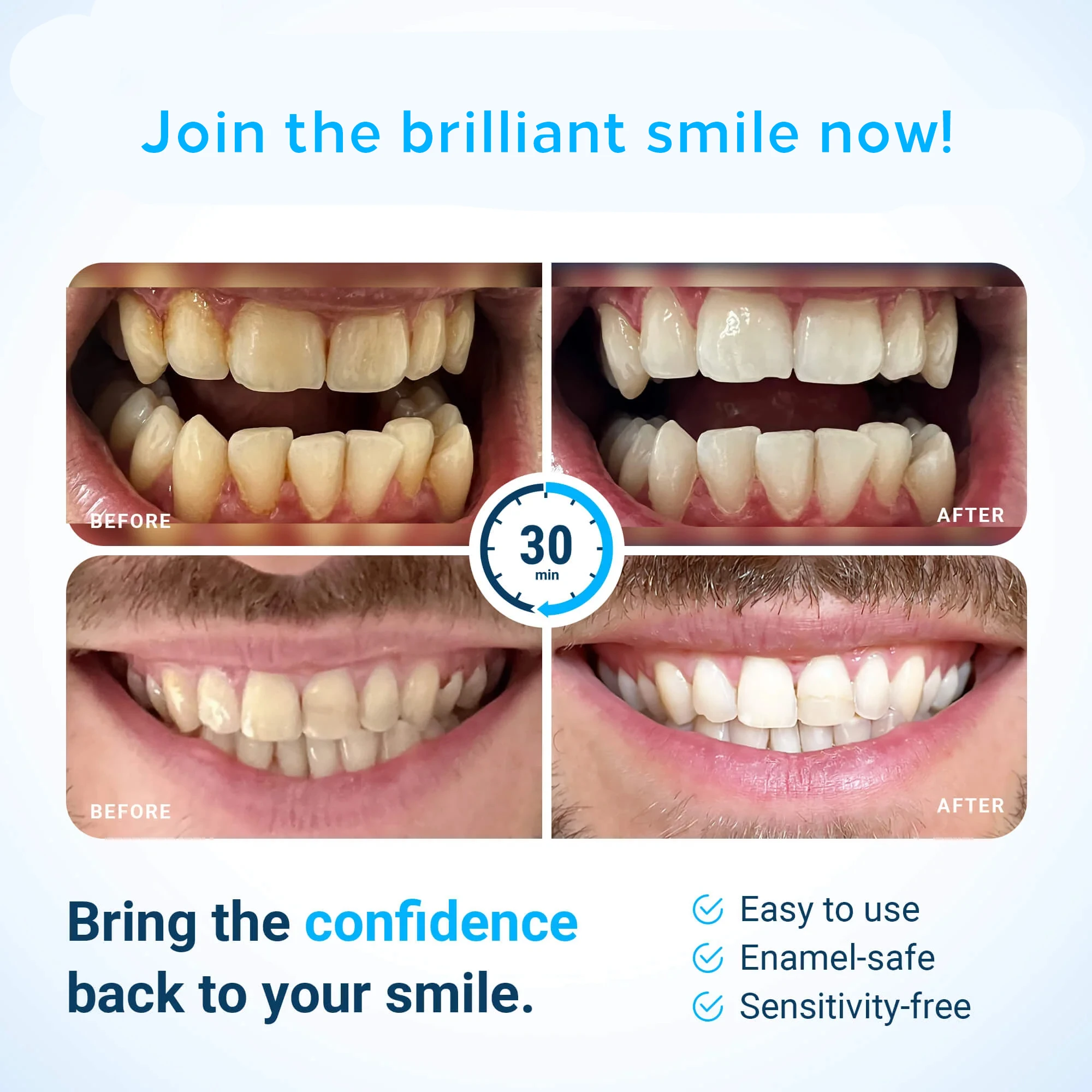 Neateeth Peach Flavoured Teeth Whitening Strips PAP Dry Strips No Slip ...