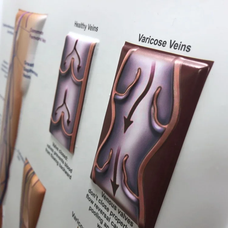 3d Embossed Medical Wall Chart For Hospital - Buy 3d Embossed Wall ...