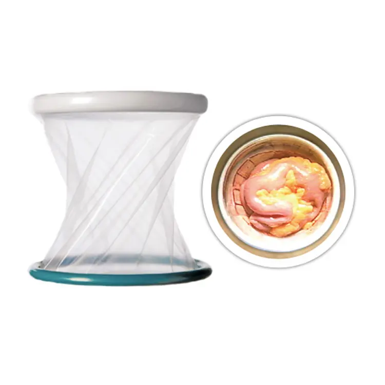 Disposable Alexis Wound Protector Retractor With Ce Iso - Buy Tpu ...